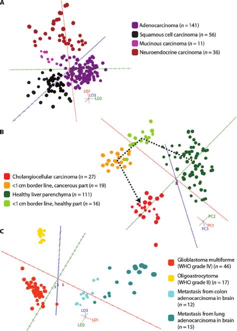 Multivariate Statistical Analysis Of Malignant Tumor Data Obtained Ex