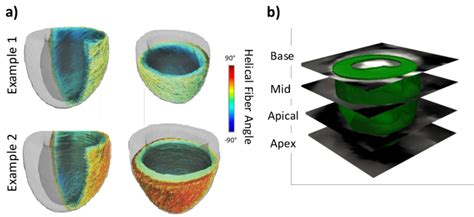 A Examples Of Synthetic Fiber Structures With Helical Fiber Angle Download Scientific Diagram