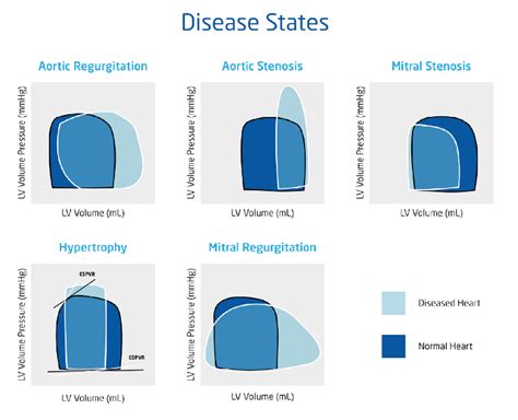Part Ii Of The Basics Of Pv Loops Preload Coupling Afterload