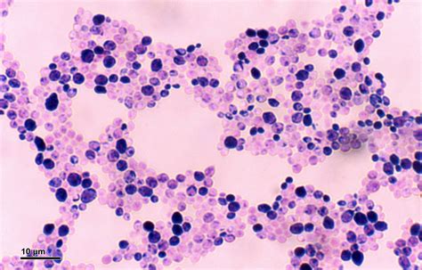 Candida Albicans Pathogenese Krankheiten Und Labordiagnose Candida