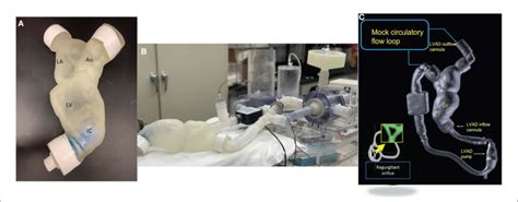 A Patient Specific Cd Printed Model B Mock Circulatory Flow Loop