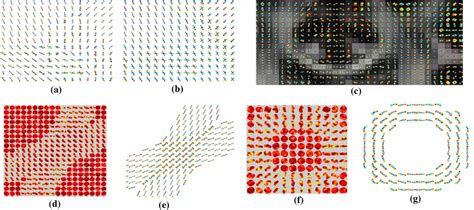 application of spatially regularized spherical deconvolution a b