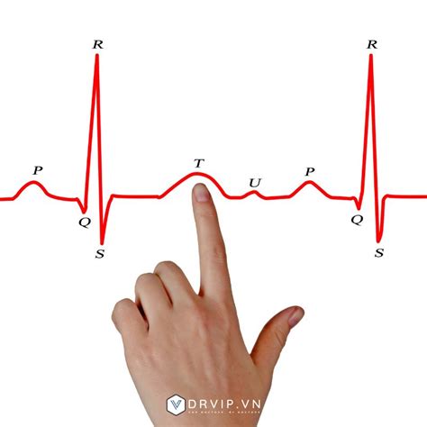 Cách đo Ecg Và Thành Phần điện Tâm đồ Drvip