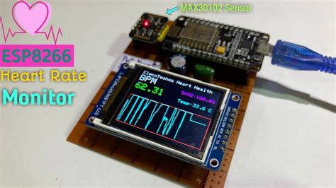 Diy Max30102 Heart Health Monitor Using Esp8266 Youtube