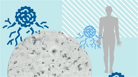 Qué Es La Candida Parapsilosis Síntomas Y El Tratamiento Del Hongo Que