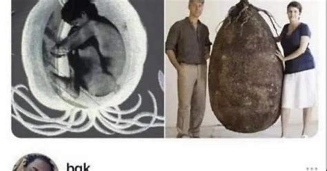 Deez Nuts Album On Imgur