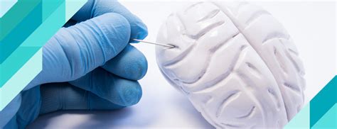 What Is Stereotactic Biopsy