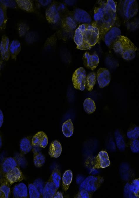 localization of synthetic b cell receptor in hek293 cells buymicroart