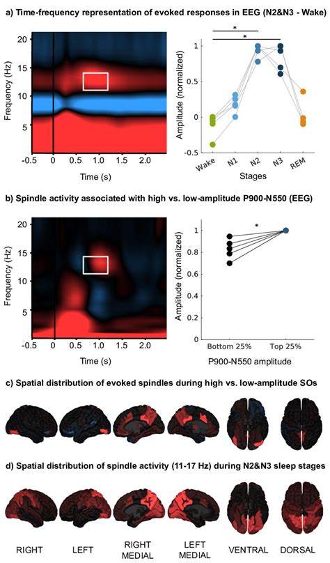 Sleep Spindles Eeg Amplitude At Howard Bradshaw Blog