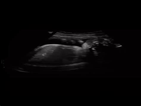 בן או בת ירדן ויזל חושפת את מין העובר Tmi