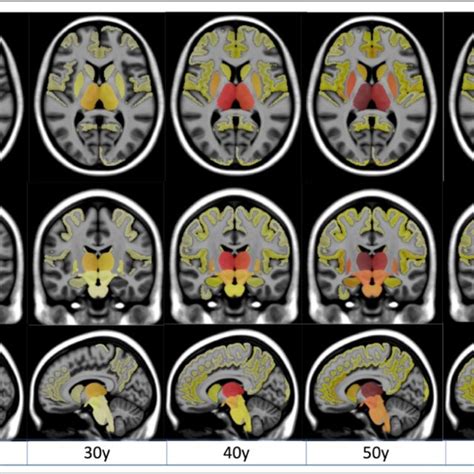 Anterior Cingulate Cortex Subregions Functional Connectivity In Download Scientific Diagram
