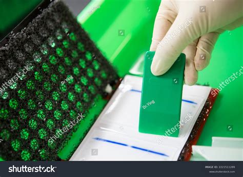 Western Blot Protein Images Stock Photos Vectors Shutterstock