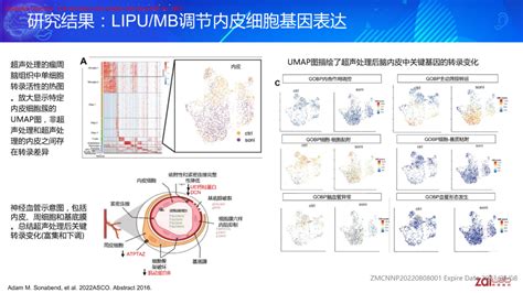 2022asco：复发胶质母细胞瘤的创新疗法—颅骨植入式超声和个性化chemoid治疗 脑医汇