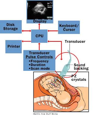 THE ELECTRIC ONLINE Ultrasound Transducer