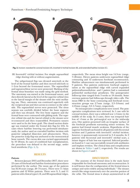 Forehead And Hairline Surgery For Gender Affirmation Kamol Cosmetic
