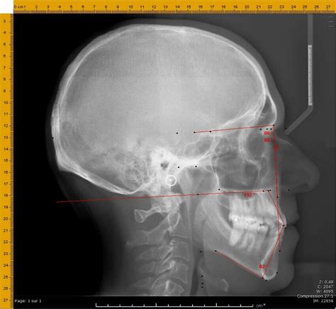 Angular Measurements Download Scientific Diagram Angular Measurements Download Scientific Diagram