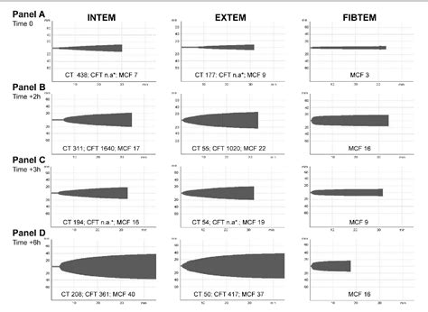 Figure 1 From Thromboelastometry Guided Therapy Of Massive Gastrointestinal Bleeding In A 12