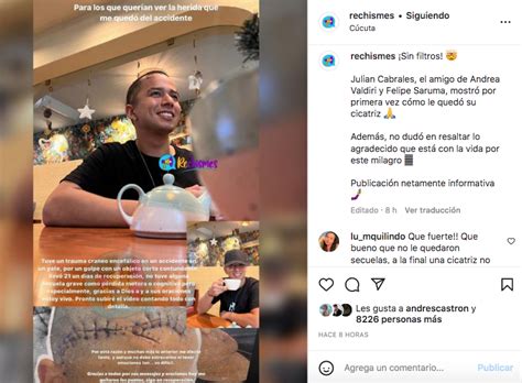 Juli N Cabrales Mostr Por Primera Vez La Herida En Su Cabeza Tras Accidente En Fin De A O Infobae