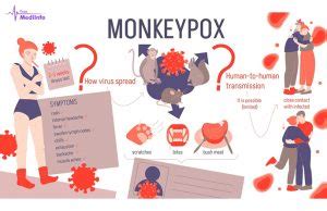 How Is The Monkeypox Spread From One Person To Another Freemediinfo