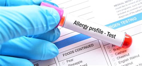 Food Sensitivity Testing Tested Hum Nutrition Blog