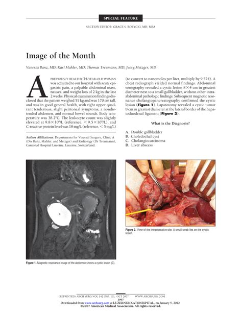 Pdf Image Of The Month Choledochal Cyst Todani Type I