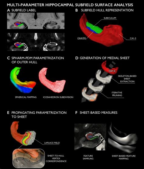 The Spectrum Of Structural And Functional Imaging Abnormalities In Temporal Lobe Epilepsy