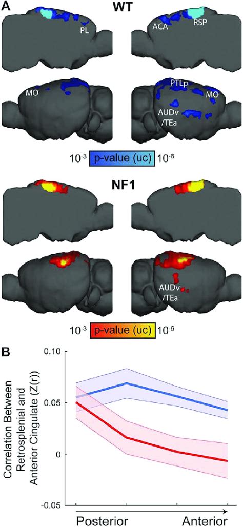 Reduced Posterior Anterior Connectivity Along The Cingulate Cortex In Download Scientific