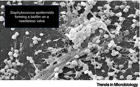 Staphylococcus Epidermidis Trends In Microbiology