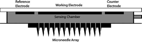 Design Development And Evaluation Of A Novel Microneedle Array Based Continuous Glucose