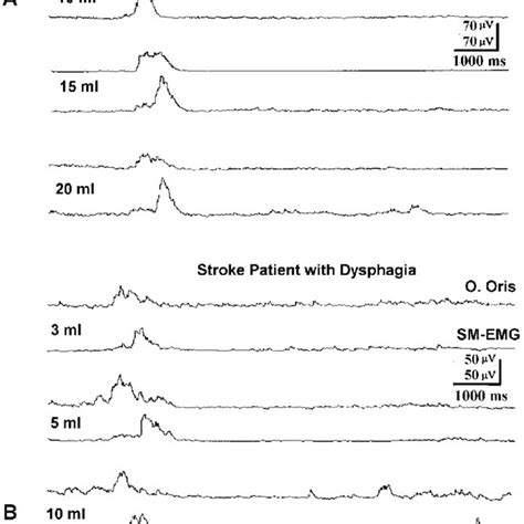 Schematic Representation Of The Central Pattern Generator Of Download Scientific Diagram