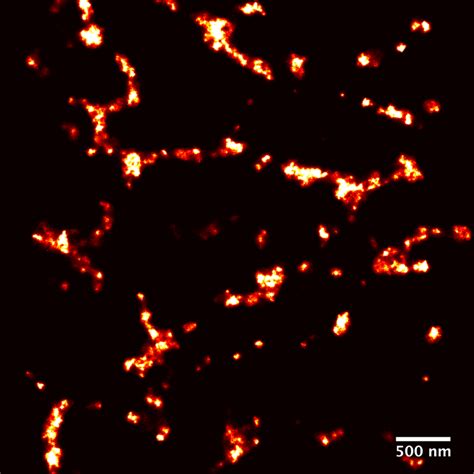 Scmos Emccd And Ccd Cameras For Microscopy