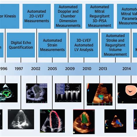 Temporal Progression In Automated Quantification In Echocardiography Download Scientific