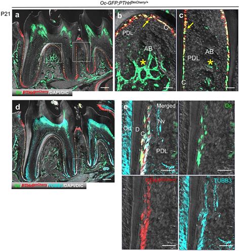 Single Cell Transcriptomic Analysis Reveals Developmental Relationships And Specific Markers Of