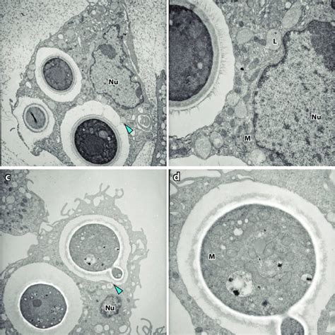 Transmission Electron Micrographs Showing Cryptococcus Neoformans And