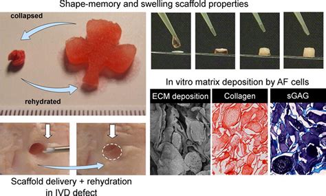 Injectable Biomaterial And Hydrogel Systems Buckley Lab