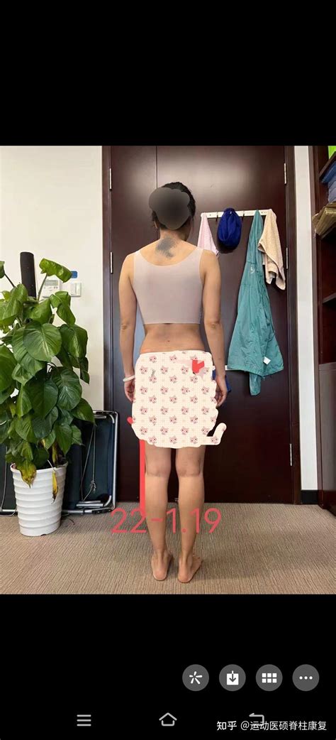 如何判断腰突颈突脊柱康复训练是否正确其实很简单但凡产生疼痛的的训练都是错误的不会看到好转迹象正确康复训练不会产生疼痛会以周为时间单位