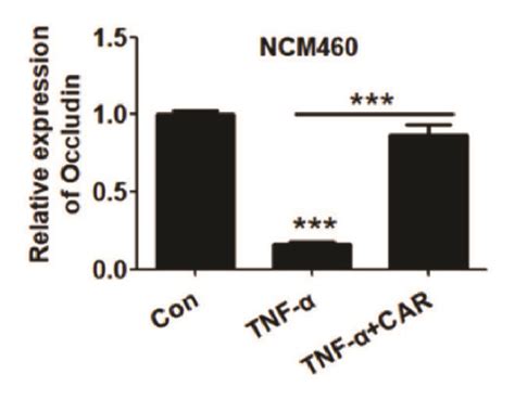 Car Overexpression Protects Human Colon Cells From Tnf α Induced Tj