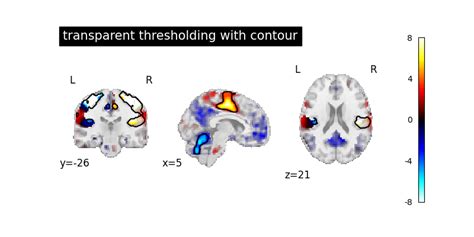 Plotting Images With Transparent Thresholding Nilearn