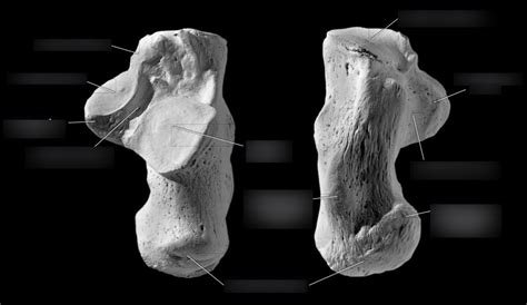 Right Calcaneus 1 Diagram Quizlet