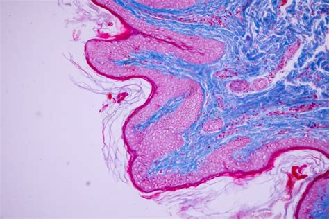 Characteristics Tissue Of Human Scalp Skin Human From General Body Surface And Showing Sweat
