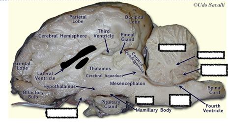 Sheep Brain Diagram Quizlet Sheep Brain Diagram Quizlet