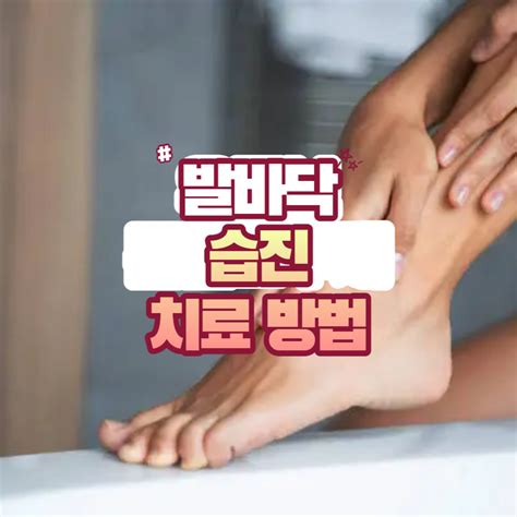 발바닥 습진 치료 방법