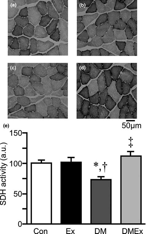 Succinate Dehydrogenase Sdh Activity Of Plantaris Muscle Sdh Download Scientific Diagram