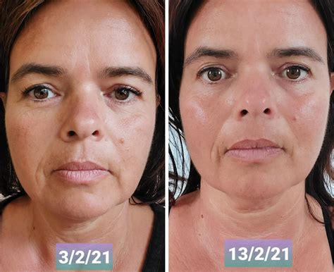 Face Yoga Before And After Images Face Yoga Australia