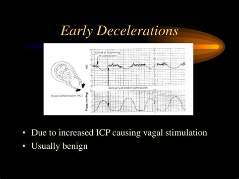 Ppt Fetal Monitoring Powerpoint Presentation Id 331037