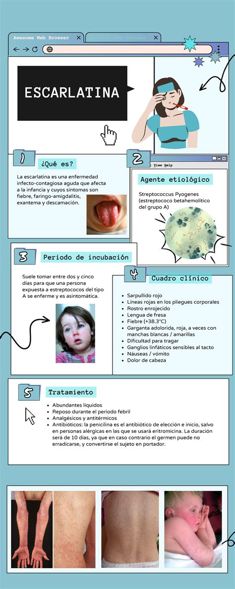 Escarlatina Agente Etiológico Streptococcus Pyogenes Estreptococo