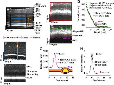 Segmentation Of Meso Outer Plexiform Layer Opl And Analysis Of Outer