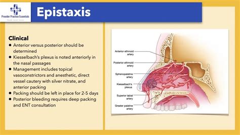 Epistaxis Management