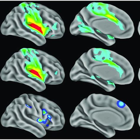 Resting State Functional Connectivity Networks Of The Posterior Insula Download Scientific