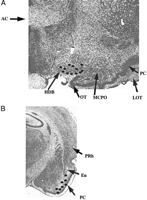 Location Of Stimulation Electrodes In Hdb And In Posterior Piriform